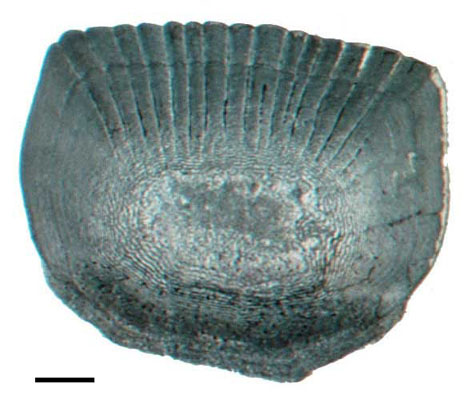 Figure 46.1. Rhacochilus vacca (PilePerch); large size; scale bar = 1.0 mm.