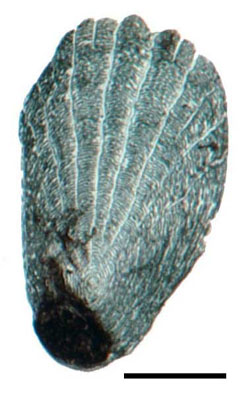 Figure 58.1. Pleuronichthys coenosus (C-O Sole); body region A; scale ...