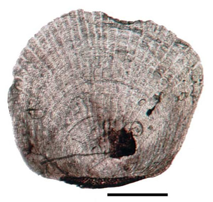Figure 58.15. Pleuronichthys coenosus (C-OSole); scale bar = 1.0 mm.